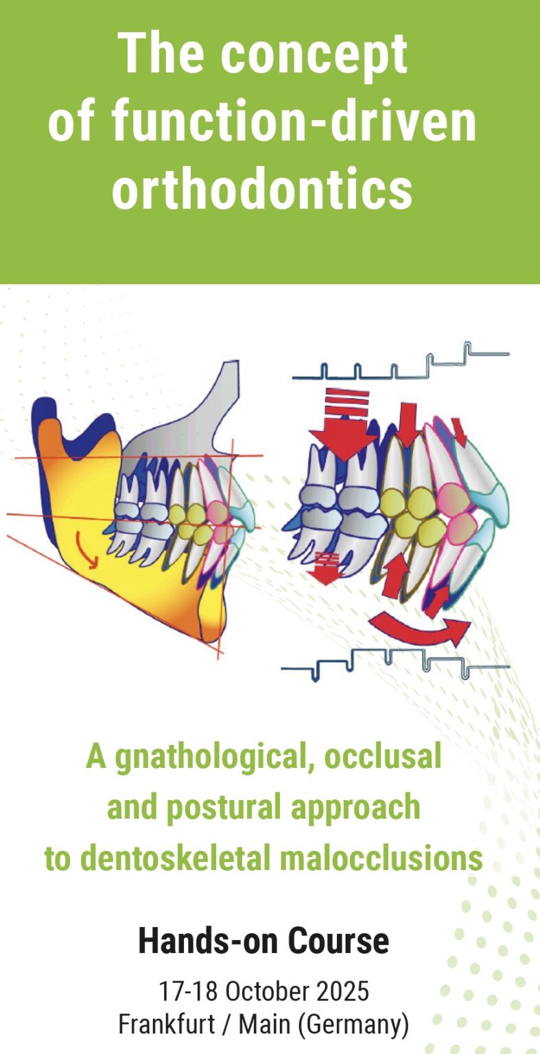 The concept of function-driven orthodontics (Hands-on Course) – RMO Europe